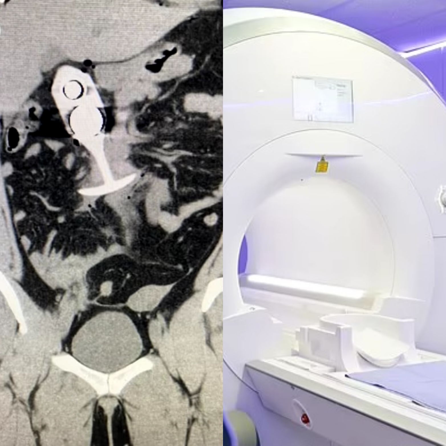 "Never wear a b#tt plug to your MRI appointment" Experts warn as woman suffers major injuries ...